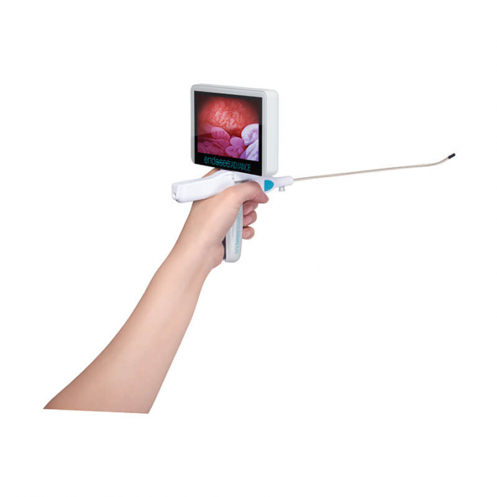 Dispositivo de histeroscopia diagnóstica Endosee® Advance - Servicios ...